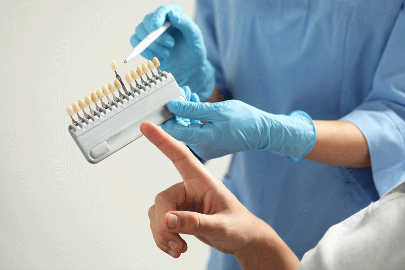 Understanding Teeth Veneers: Dive into the Meaning of Porcelain Veneers ...